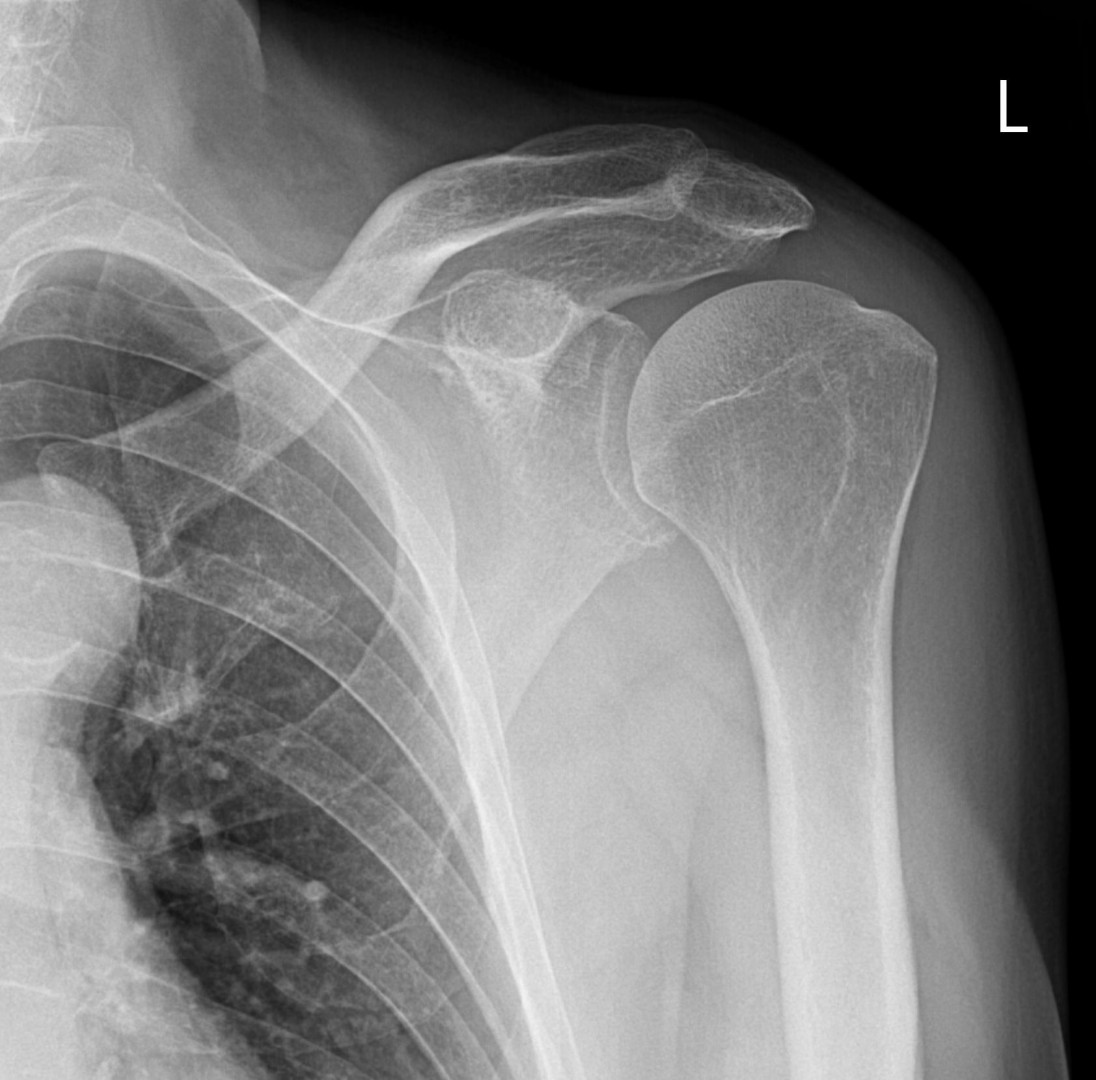 Rentgen RTG Kraków Prądnik Pracownia Cyfrowej Diagnostyki Obrazowej