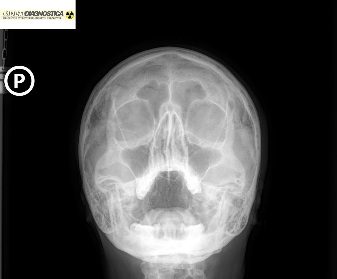 Rentgen RTG Kraków Prądnik Pracownia Cyfrowej Diagnostyki Obrazowej