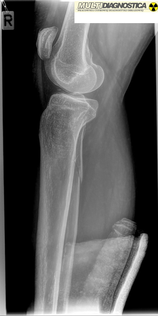 Rentgen RTG Kraków Prądnik Pracownia Cyfrowej Diagnostyki Obrazowej