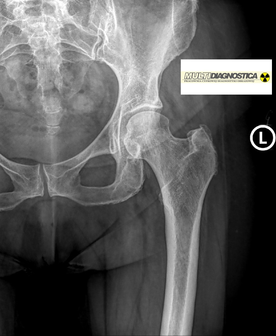 Rentgen RTG Kraków Prądnik Pracownia Cyfrowej Diagnostyki Obrazowej