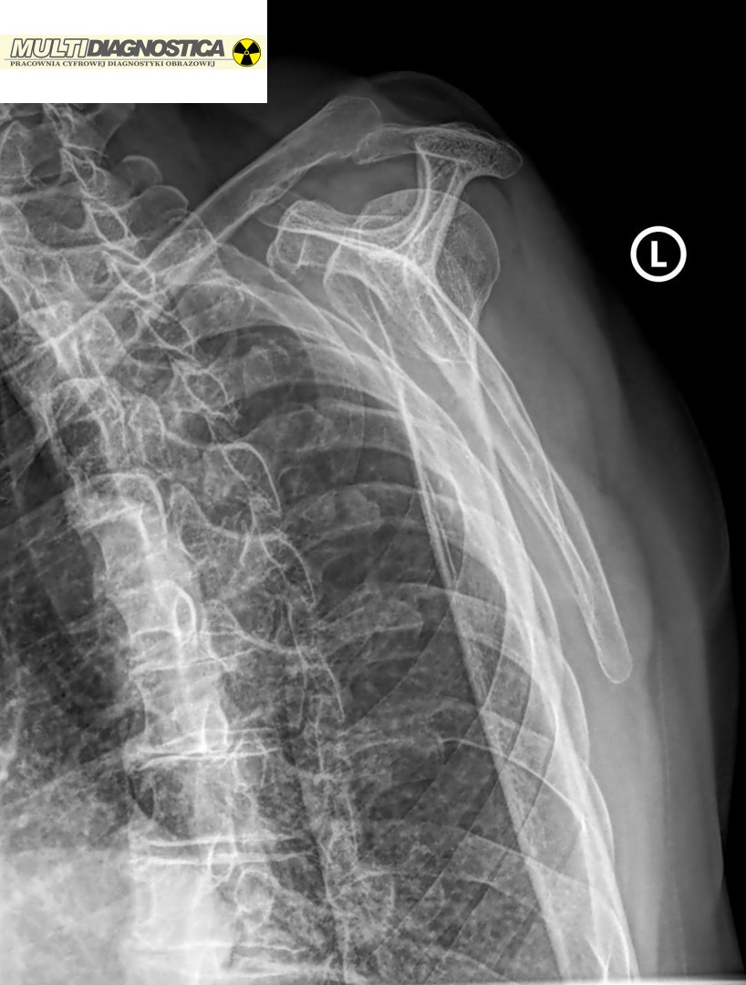 Rentgen RTG Kraków Prądnik Pracownia Cyfrowej Diagnostyki Obrazowej