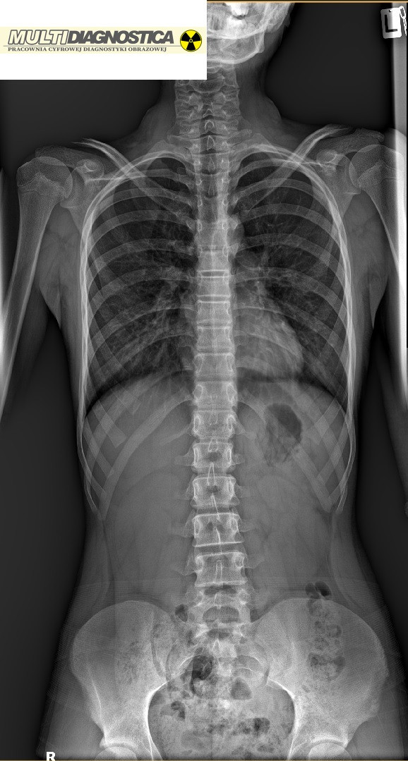 Rentgen RTG Kraków Prądnik Pracownia Cyfrowej Diagnostyki Obrazowej