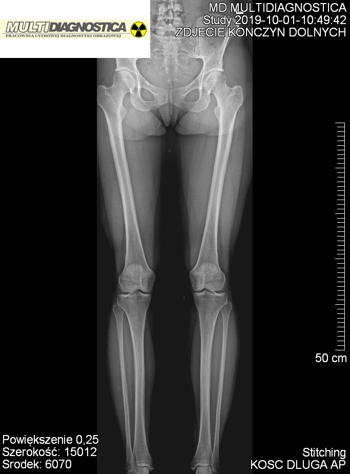 Rentgen RTG Kraków Prądnik Pracownia Cyfrowej Diagnostyki Obrazowej